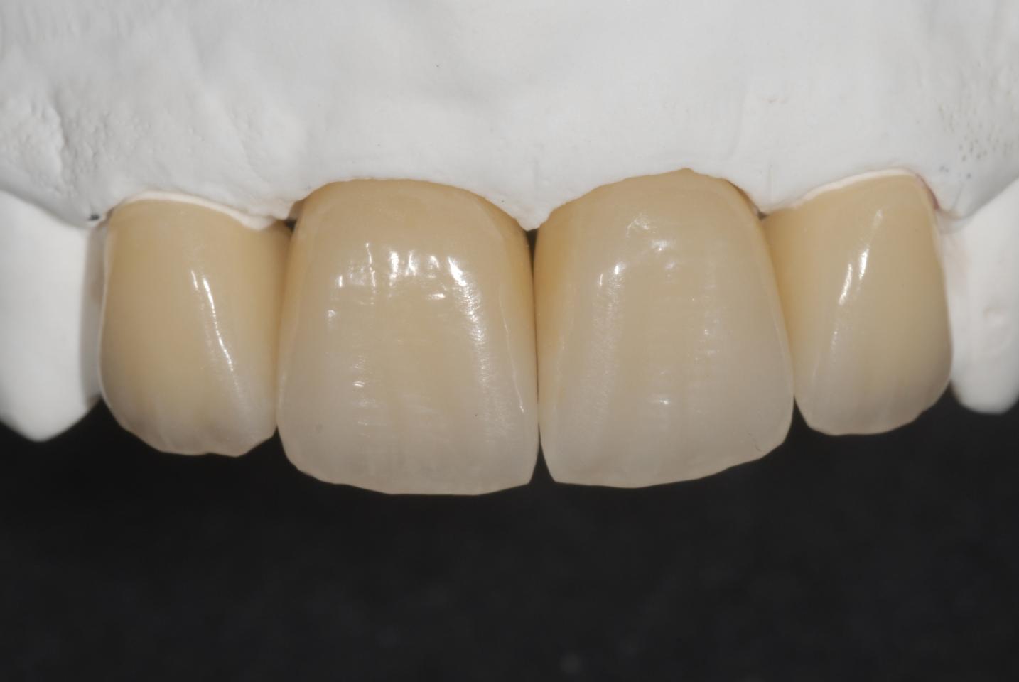 Articles - Forum Implantologicum - ITI