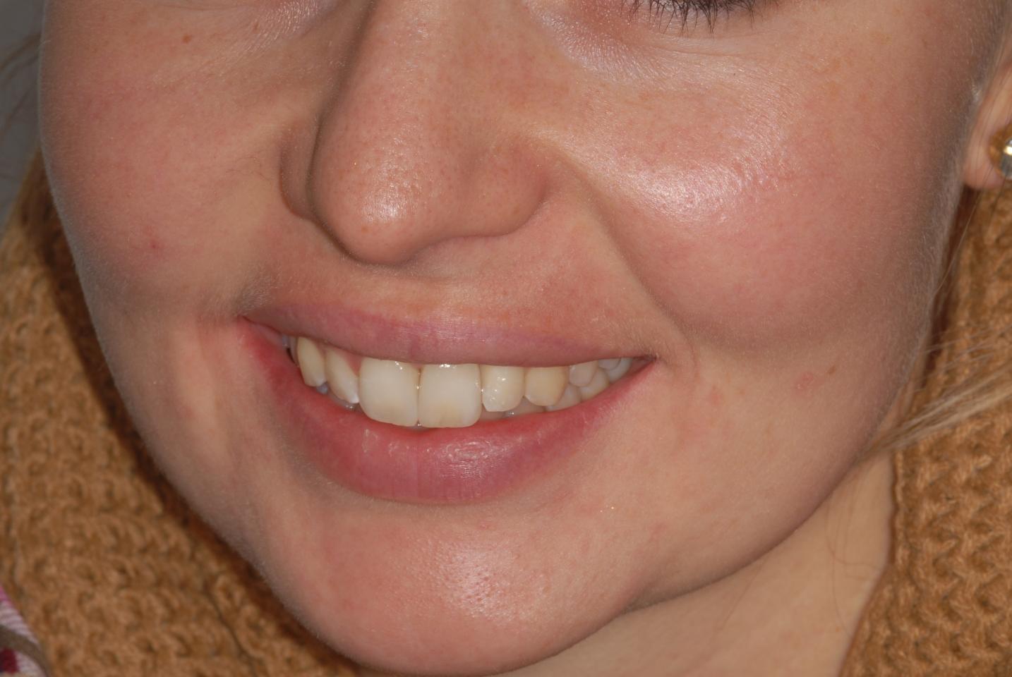 Articles - Forum Implantologicum - ITI