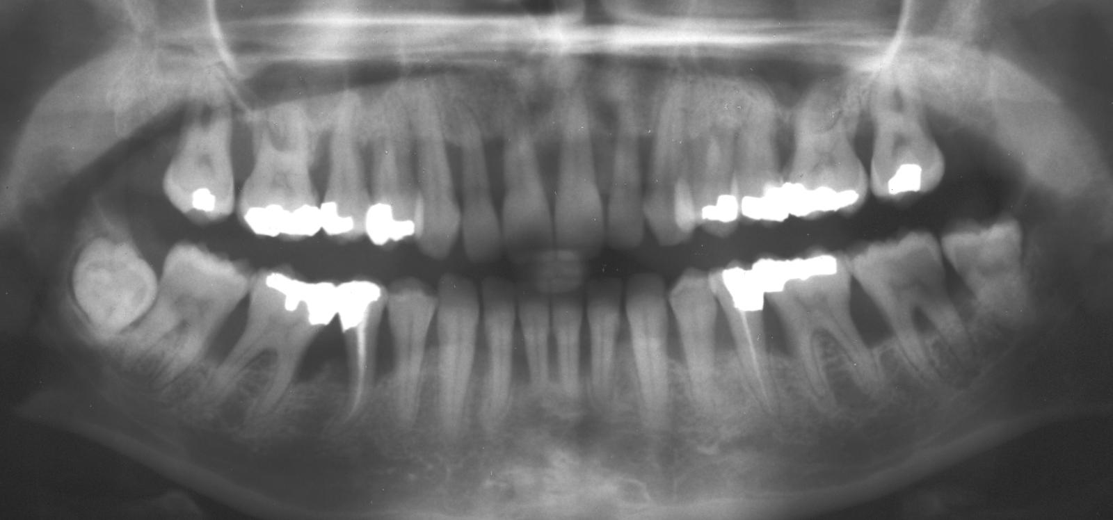 Articles - Forum Implantologicum - ITI