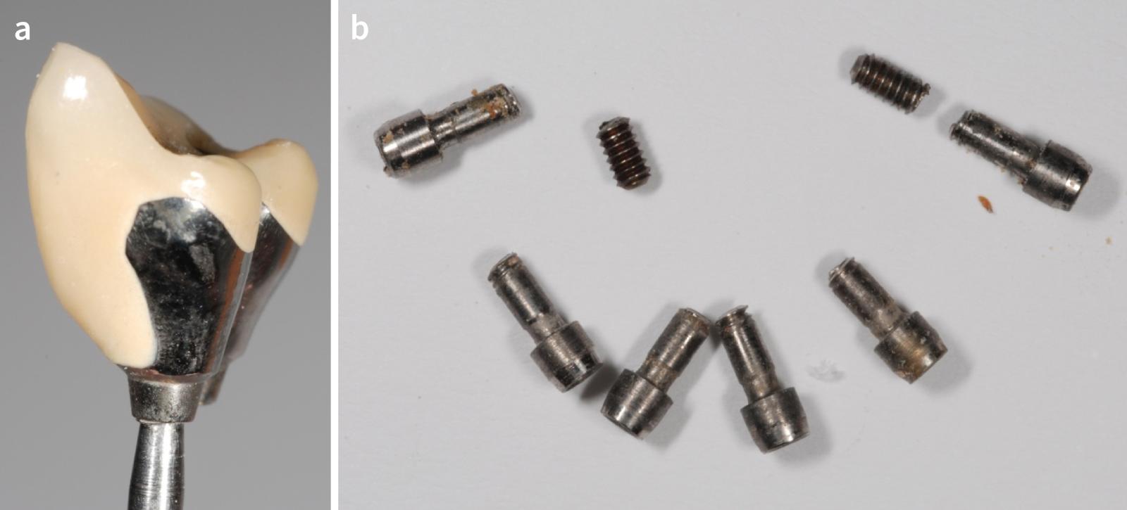 Articles - Forum Implantologicum - ITI