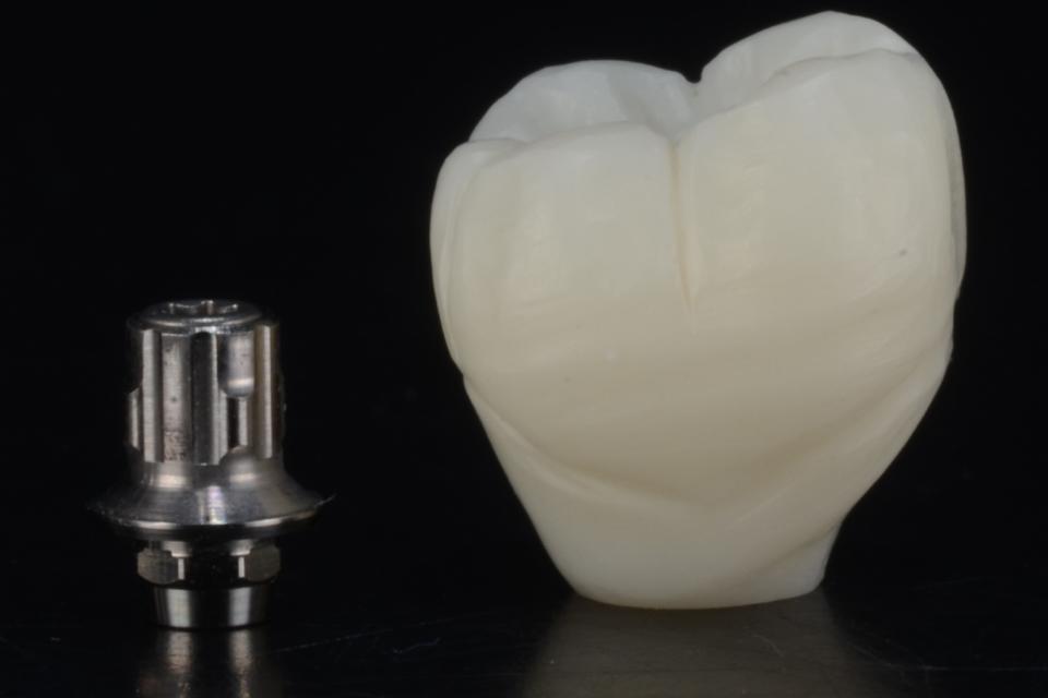 Articles - Forum Implantologicum - ITI