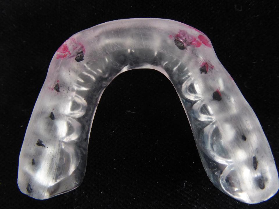 Articles - Forum Implantologicum - ITI