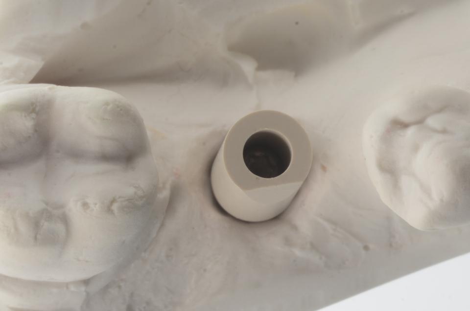 Articles - Forum Implantologicum - ITI