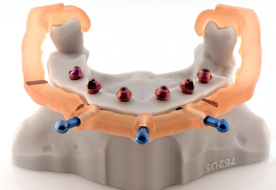 Articles - Forum Implantologicum - ITI